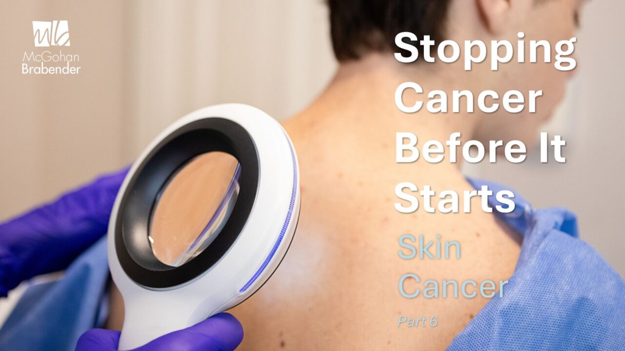 Stopping Cancer Before It Starts: Skin Cancer - McGohan Brabender